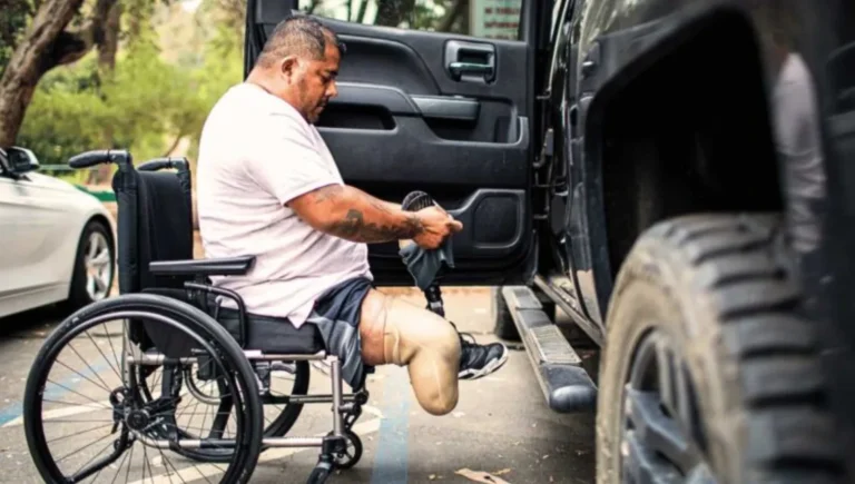 Losing a Limb in a Car Accident – The Physical and Emotional Toll of ...